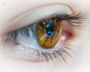 Minimally-invasive laser eye treatment for floaters - Tanner Eyes